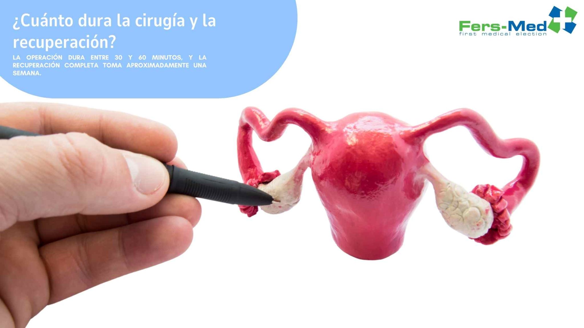 Salpingoclasia (OTB) | Método Anticonceptivo Permanente